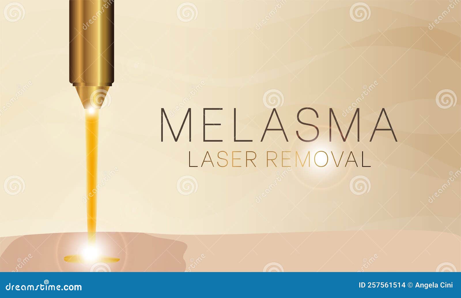 Melasma Laser Removal Background Illustration Stock Vector ...