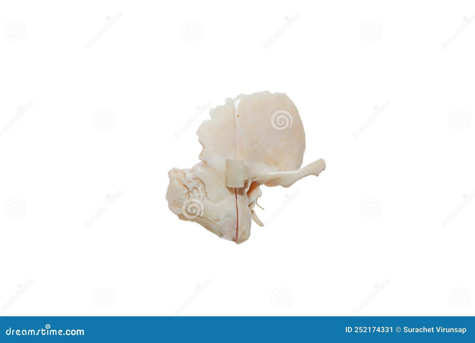 Membrana Para O Estudo Do Osso Temporal. Osso Da Anatomia Imagem de ...