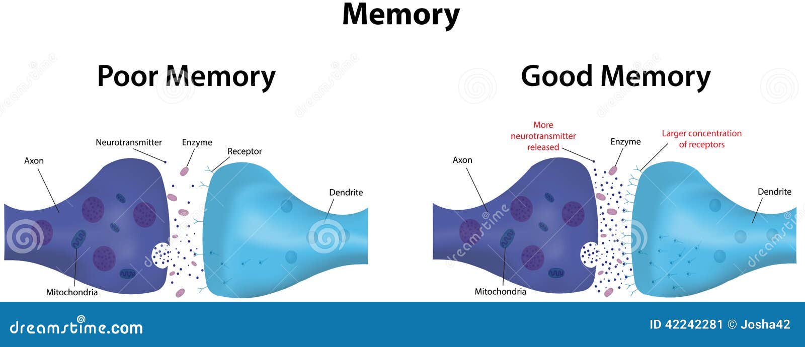 Serotonin Syndrome Vector Illustration With Medical Labeled Symptoms ... Serotonin Syndrome Vector Illustration With Medical Labeled Symptoms ...