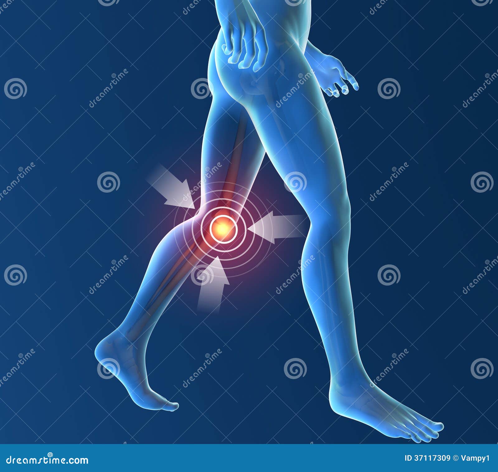 Men S Skeleton, Knee Inflammation Stock Illustration - Illustration of ...