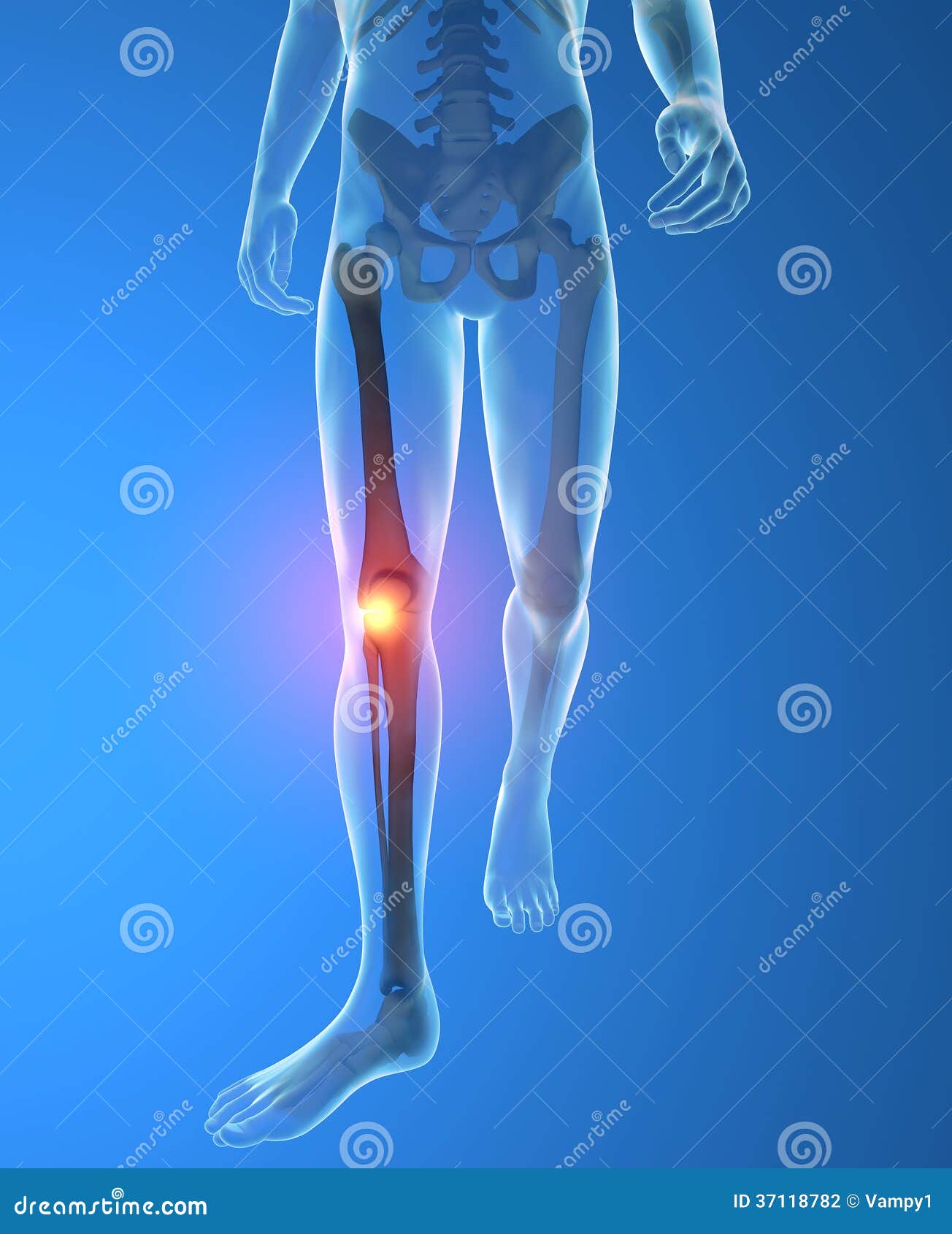 Men S Skeleton, Knee Inflammation Stock Illustration - Illustration of ...