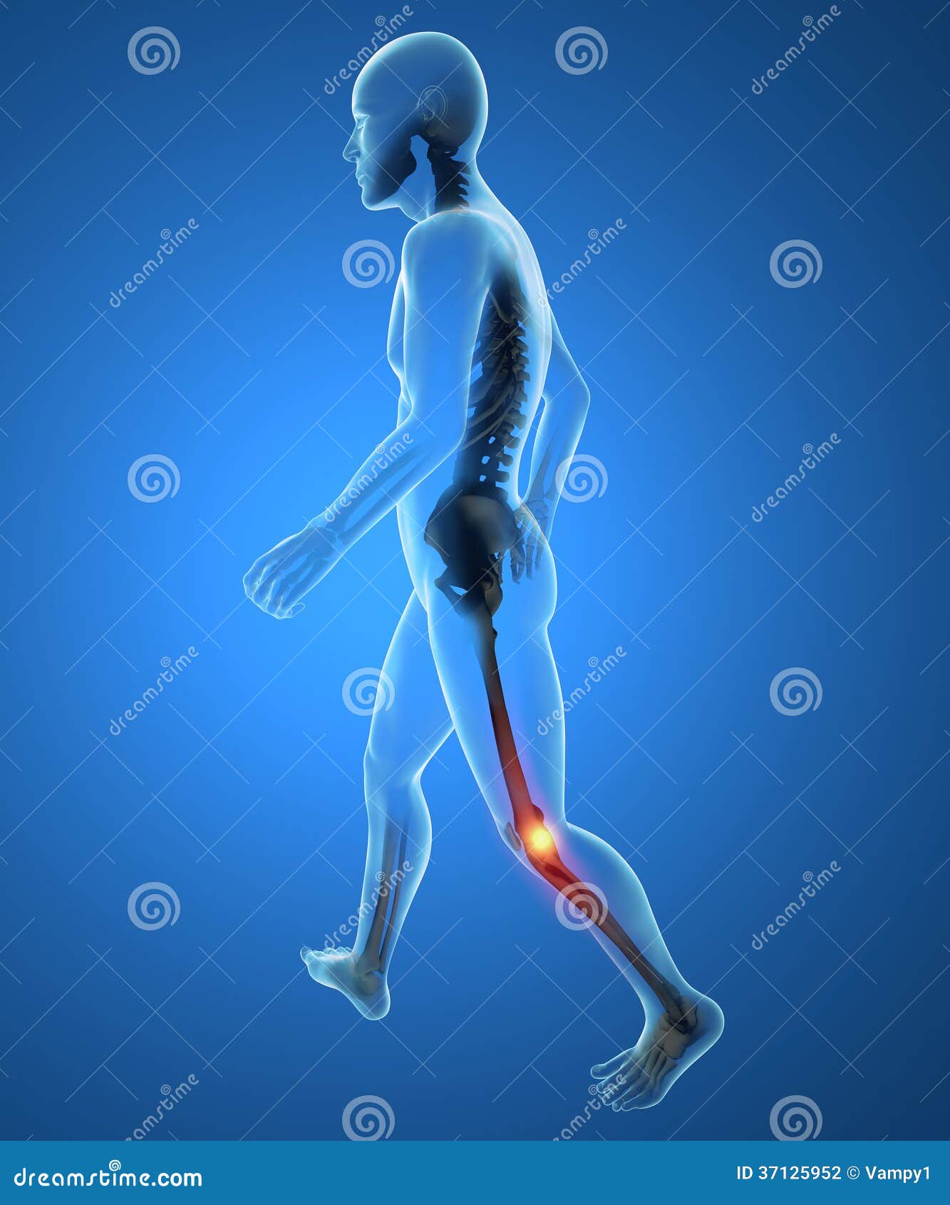 Men S Skeleton, Knee Inflammation Stock Illustration - Illustration of ...