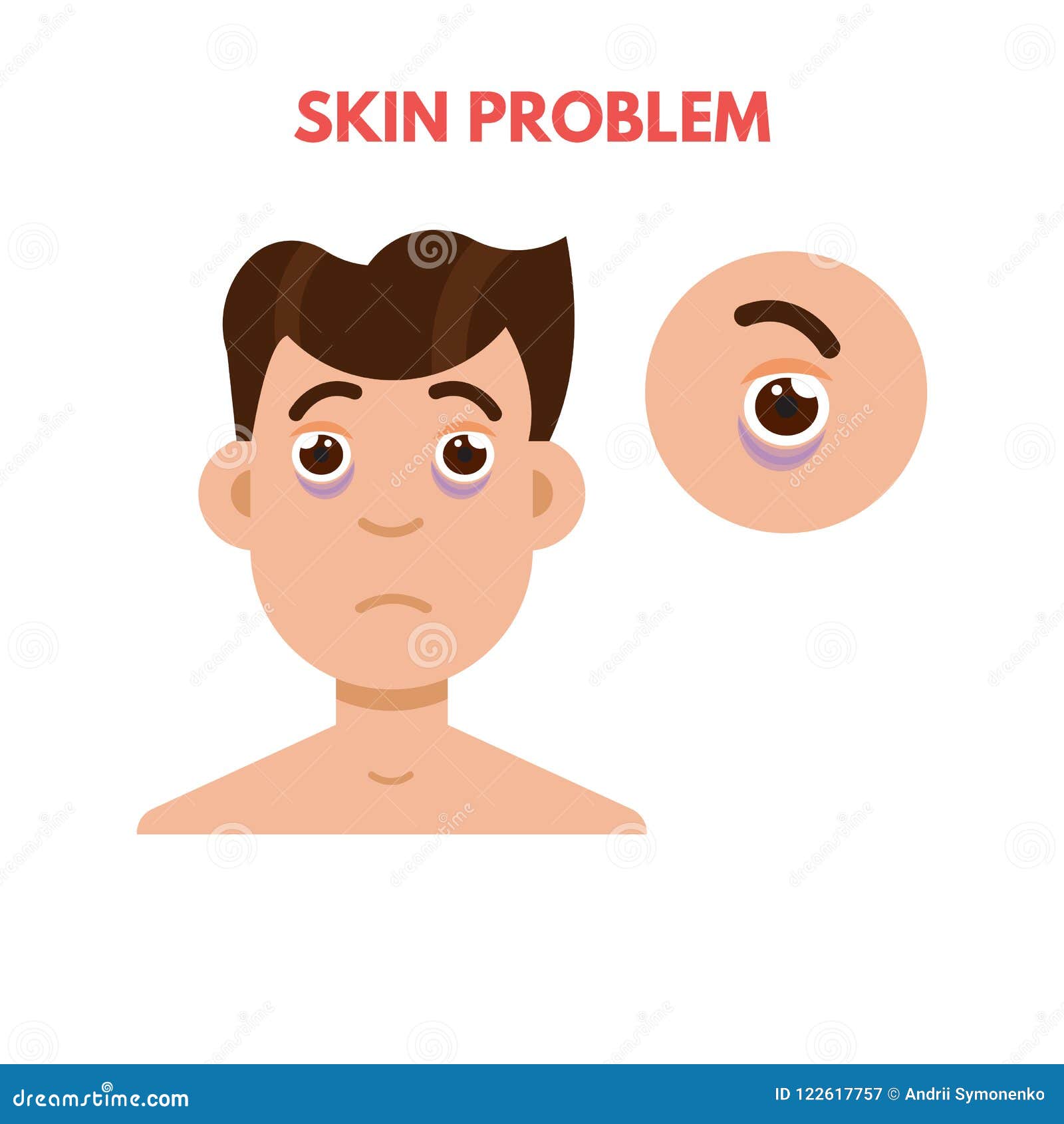 Men Skin Problem. Facial Care Stock Vector - Illustration of medical ...