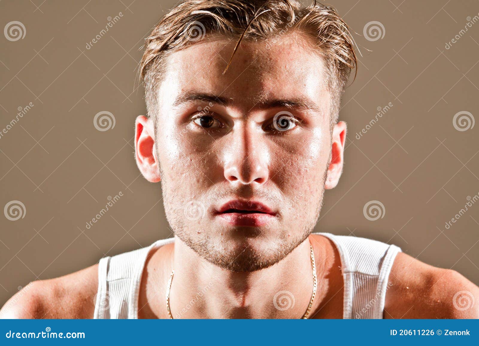 Men skin problems stock photo. Image of blackheads, blister - 20611226