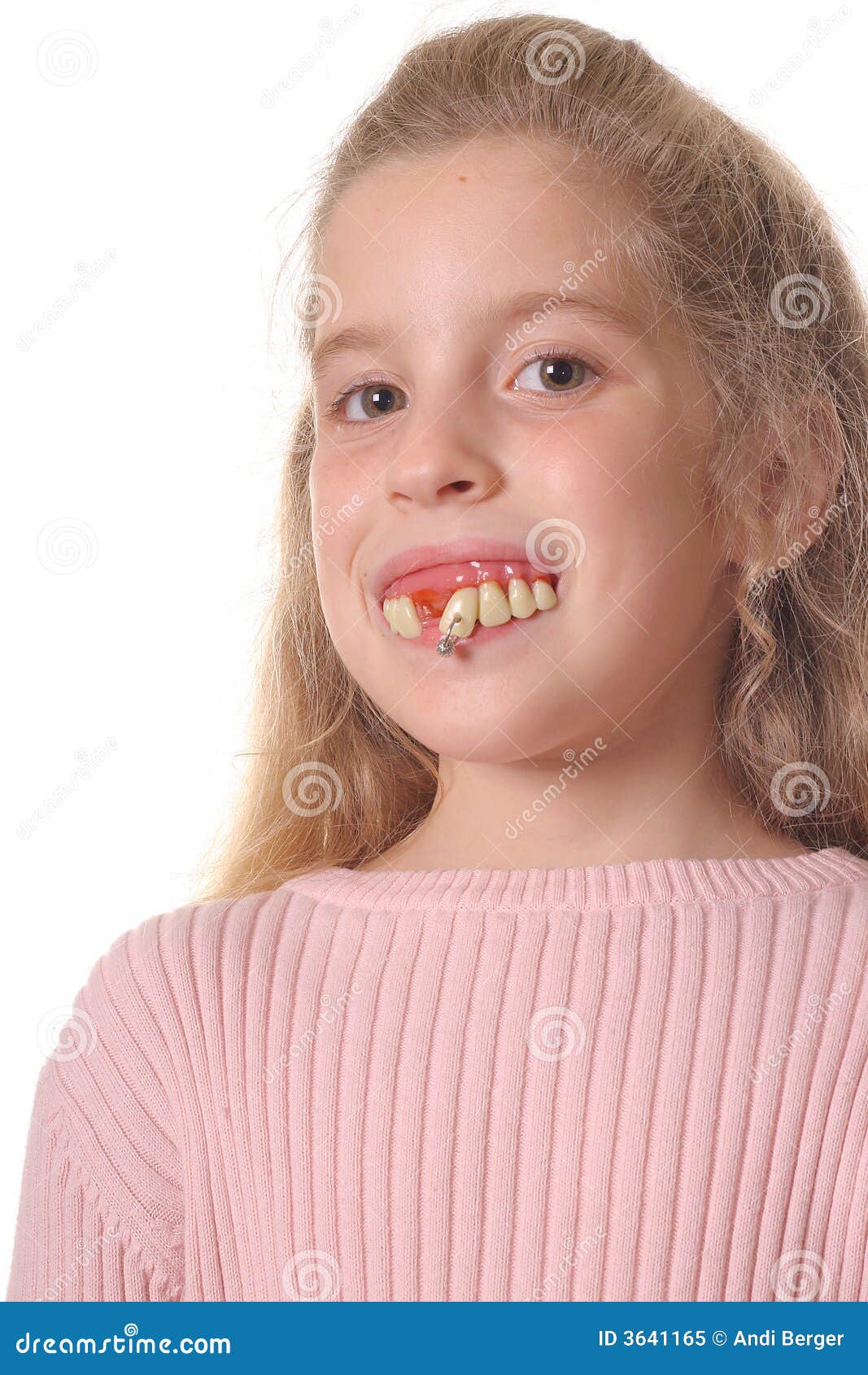 Bebes Feios Do Mundo