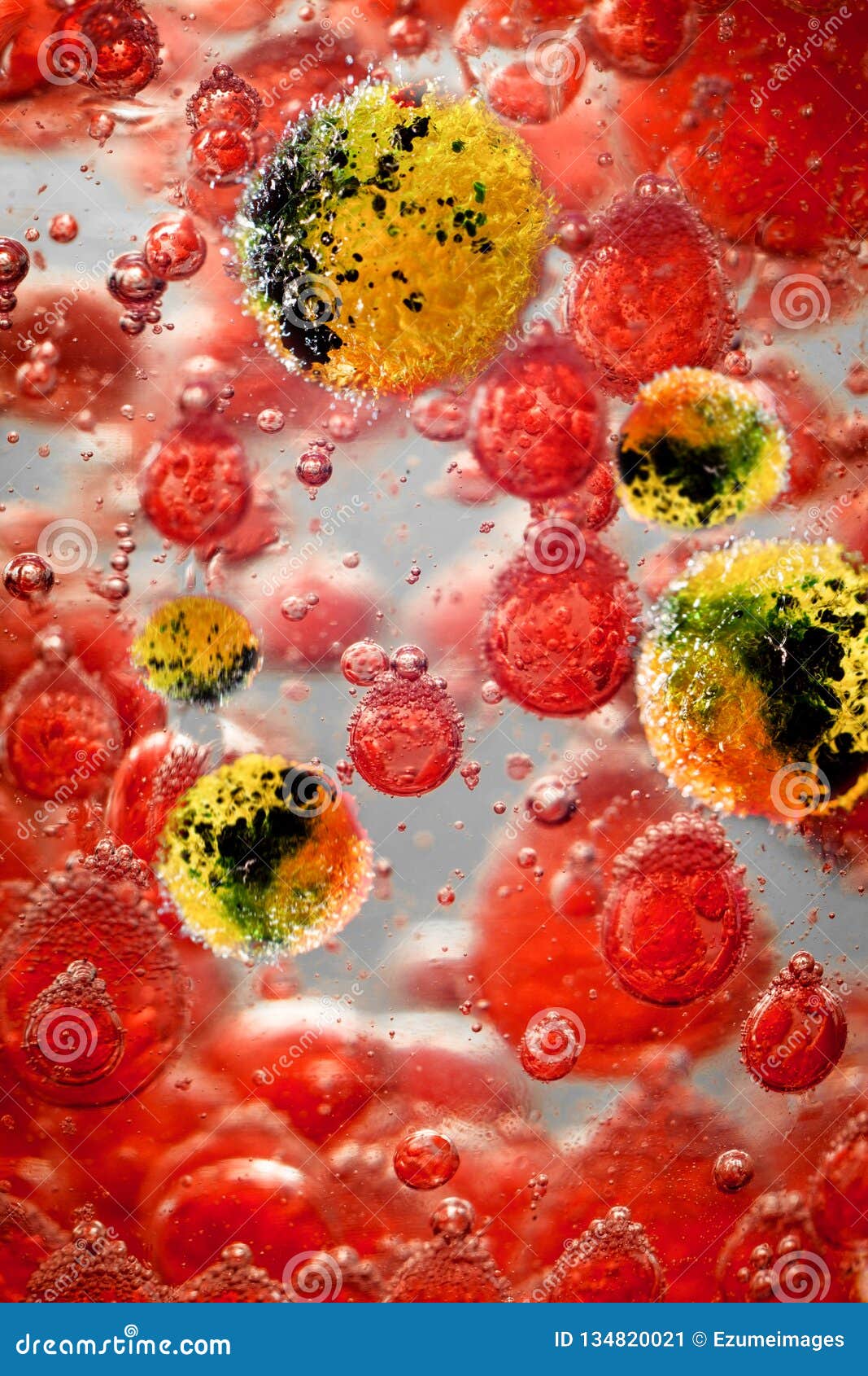 Meningitis Bacteria Infection Stock Image - Image of contagion, science ...