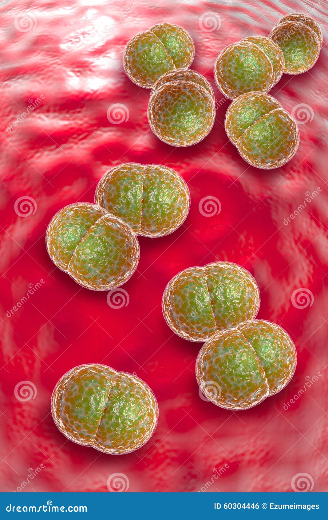 Meningitis Bacteria Infection Stock Illustration - Illustration of ...