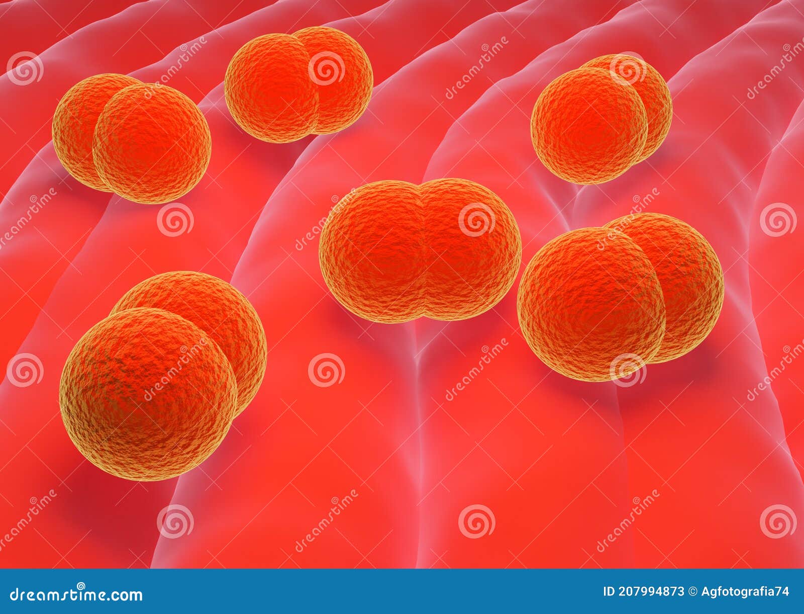 Meningococcus are Bacteria that Cause Meningitis, a Severe Inflammation ...