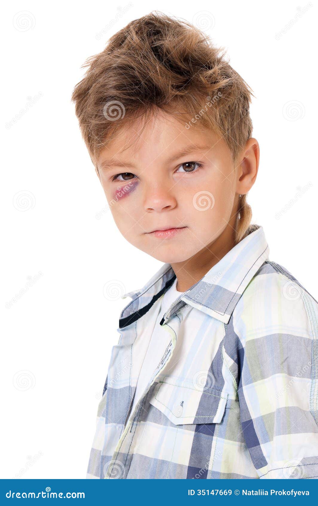 Menino com equimose imagem de stock. Imagem de olho, sofra - 35147669