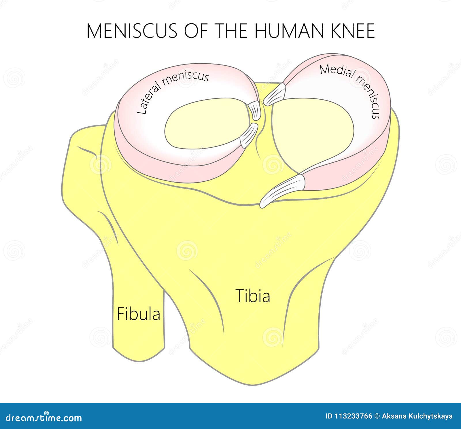 Meniskus _Human Knie vektor abbildung. Illustration von versetzung ...