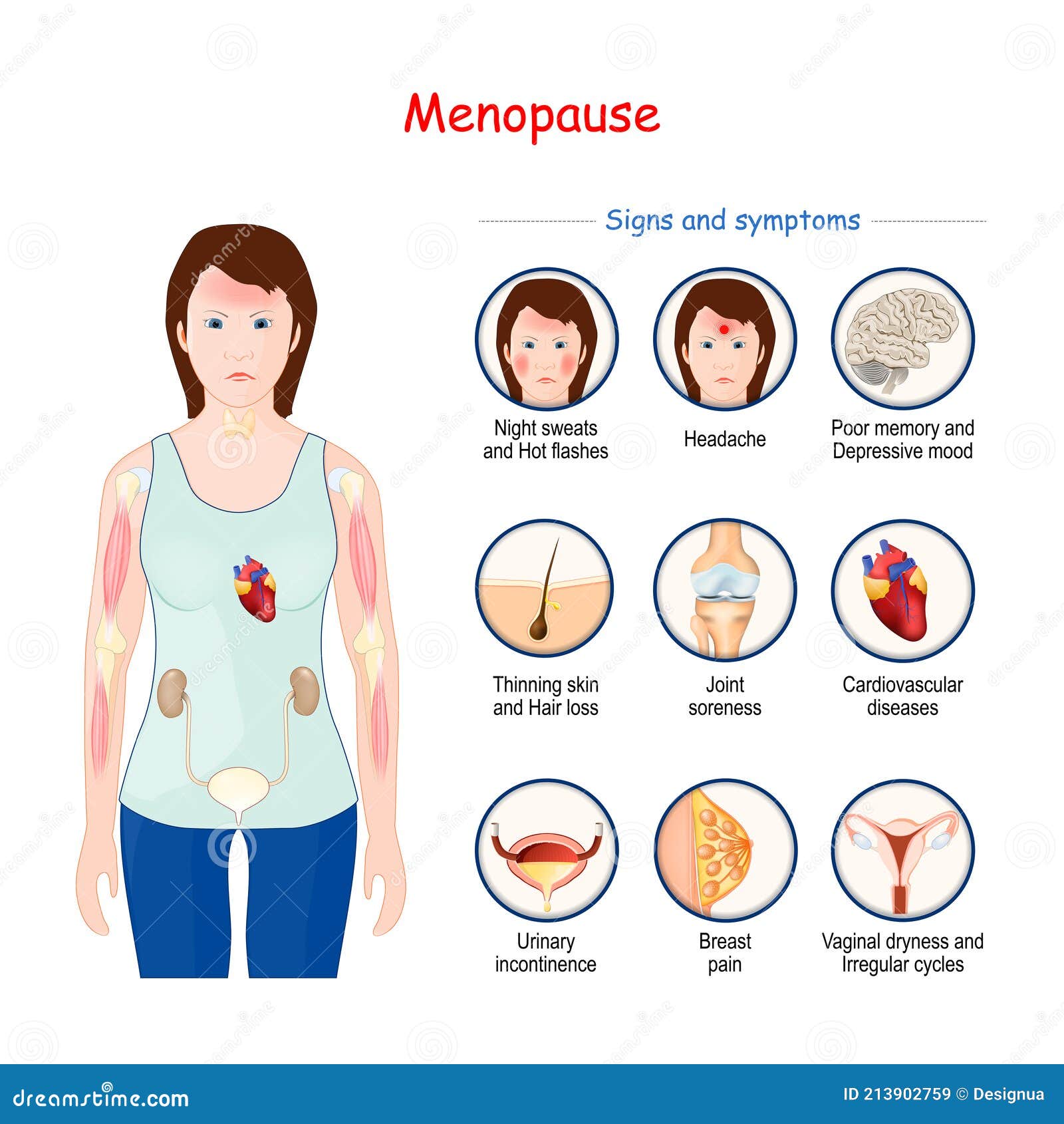 Menopause Climacteric Signs And Symptoms Stock Vector Illustration