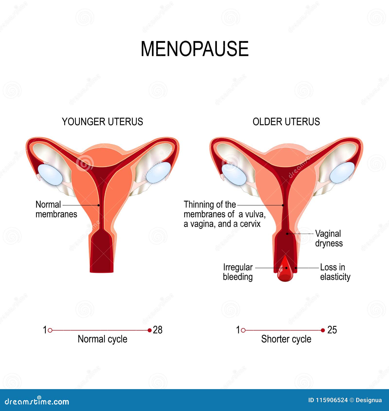 Menopause Or Climacteric Younger And Older Women Uterus Stock Vector