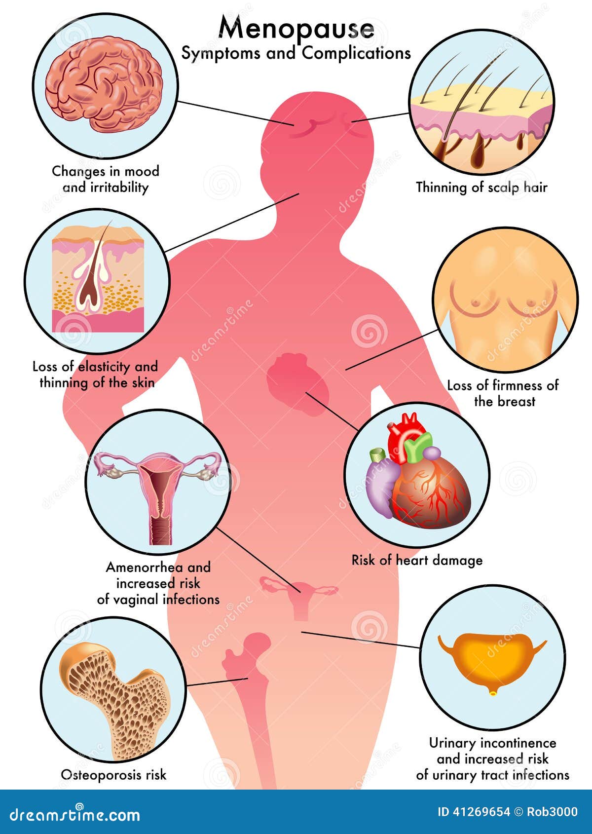 Menopause stock vector. Illustration of gain, infections - 41269654 Menopause stock vector. Illustration of gain, infections - 41269654
