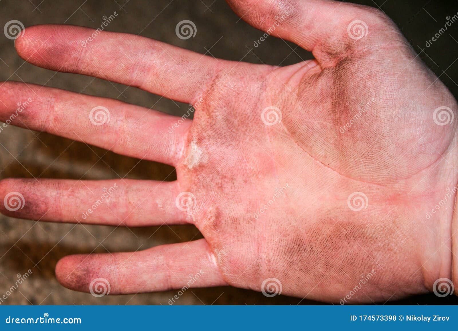 Mens Dirty Hand. Corns on Their Hands Stock Photo - Image of male ...