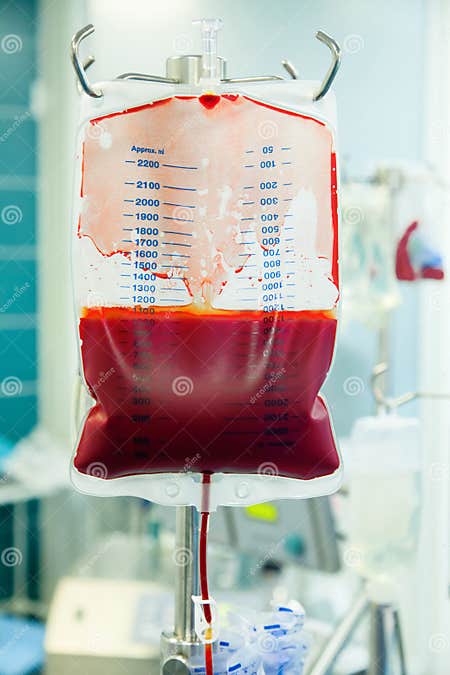Menschliche Bluttransfusion Stockbild - Bild von makro, leute: 25468847