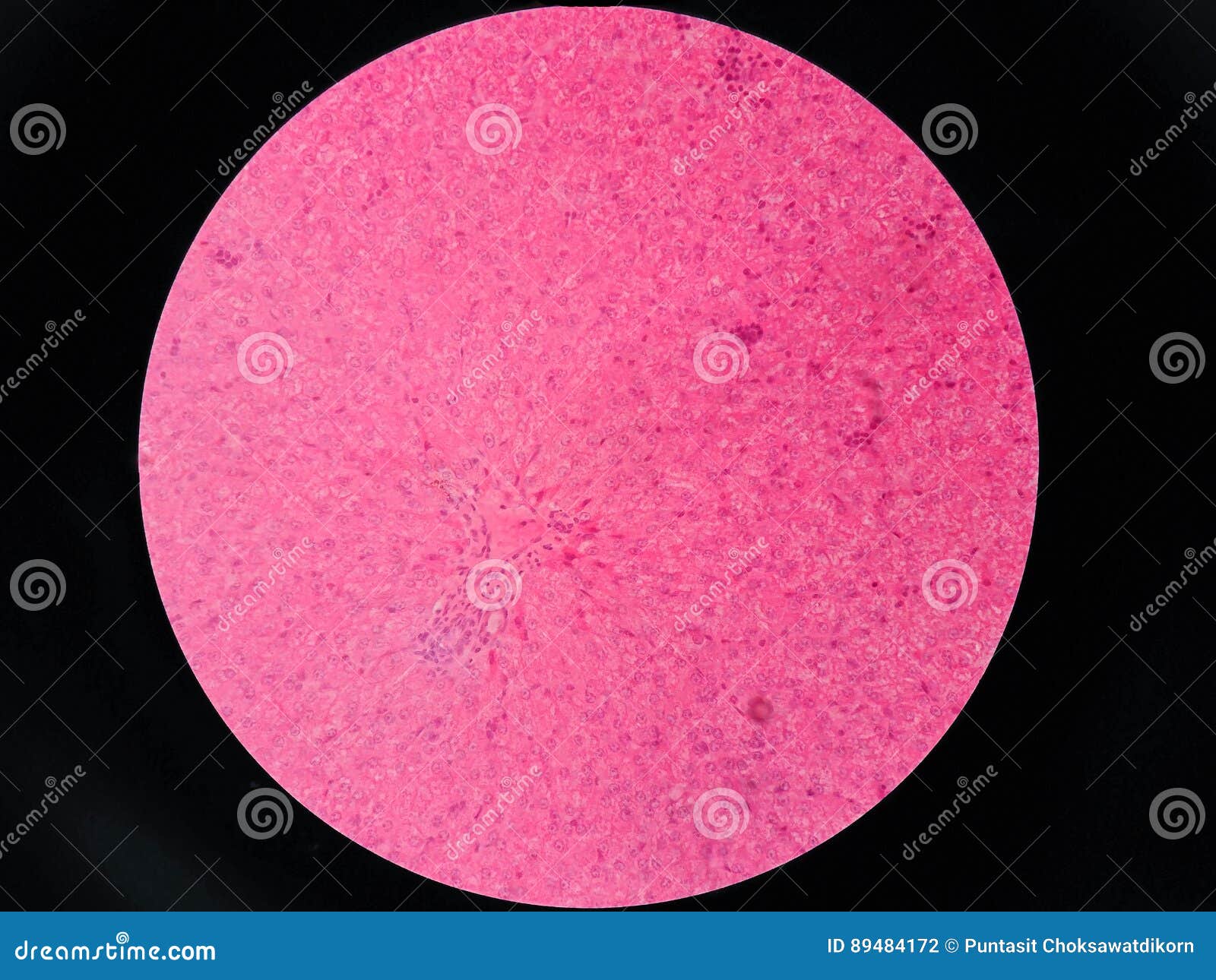Menschliche Leberzelle stockfoto. Bild von medizin, mikro - 89484172
