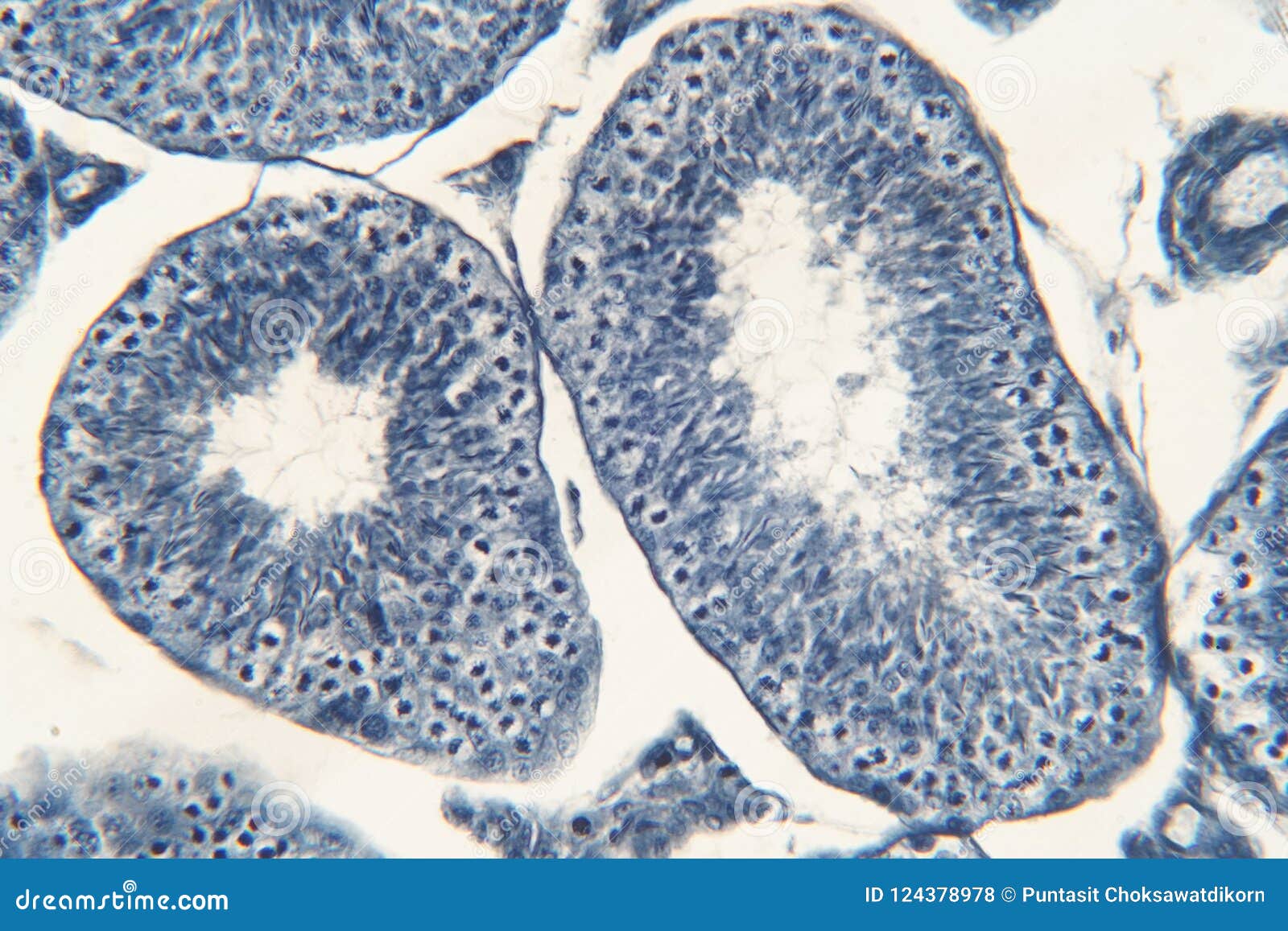 Menschlicher Testikel Unter Mikroskopansicht Stockfoto - Bild von ...