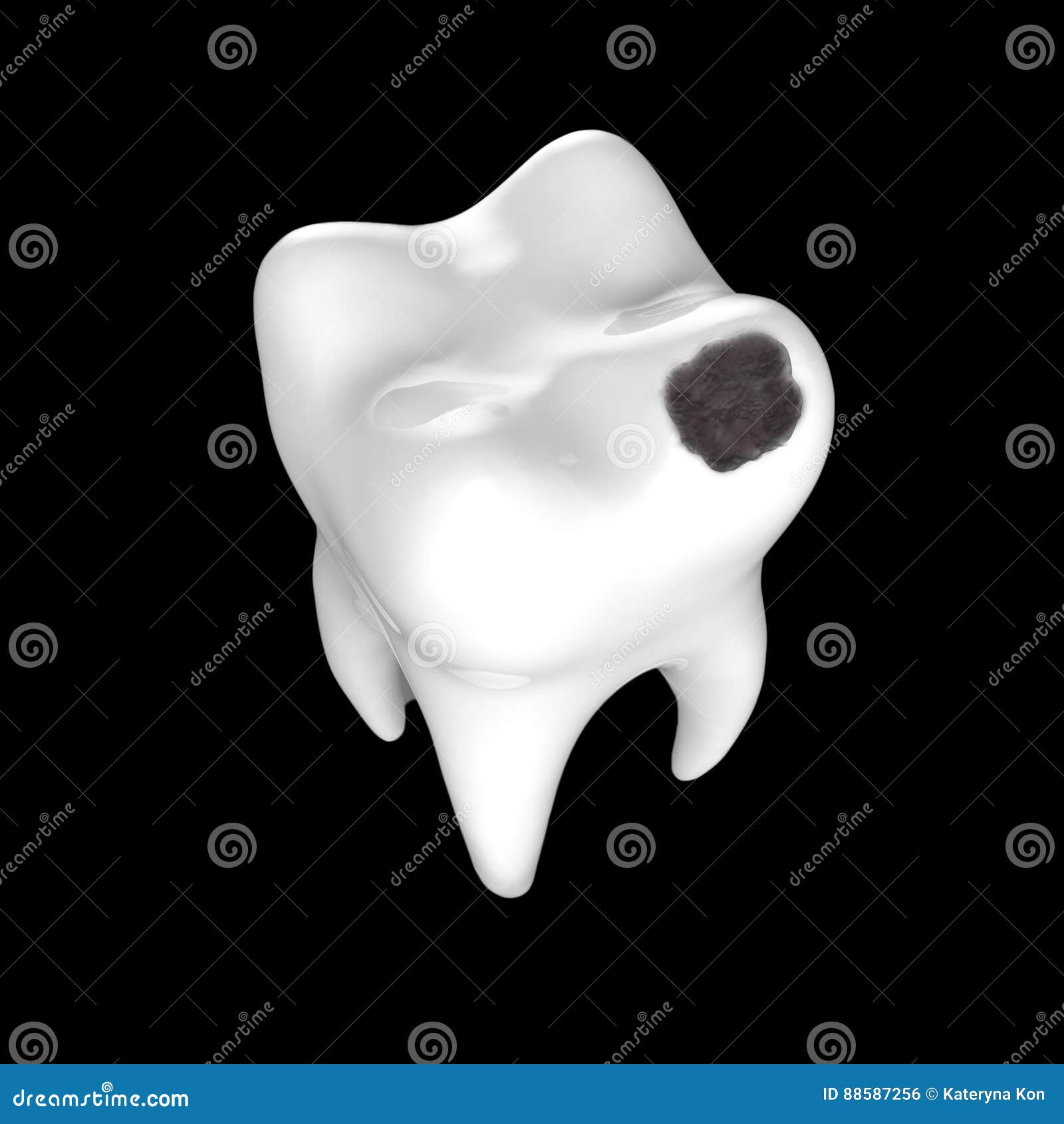 Menschlicher Zahn Mit Schwarzem Loch Stock Abbildung - Illustration von ...