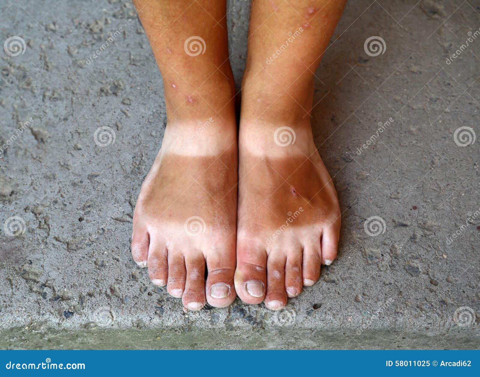 Menschliches Bein, Ein Fragment Stockbild - Bild von nanometer, heber ...