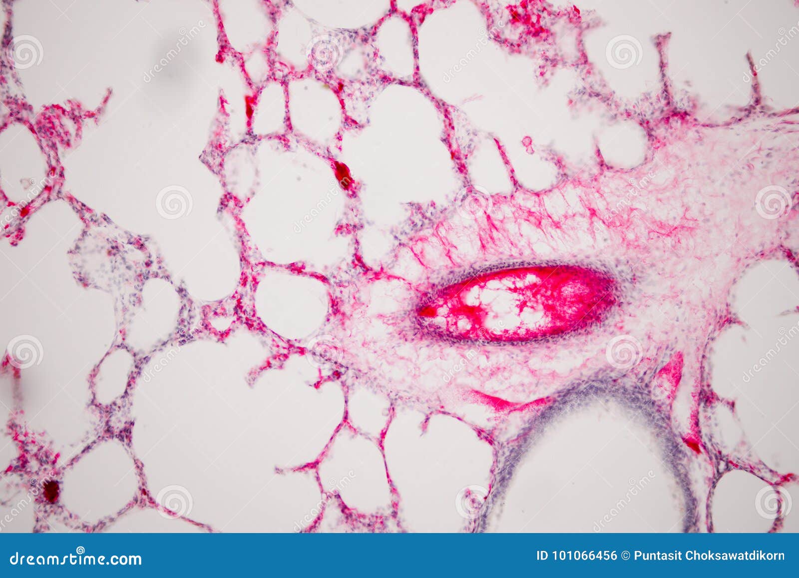 Menschliches Lungengewebe Unter Mikroskopansicht Stockfoto - Bild von ...