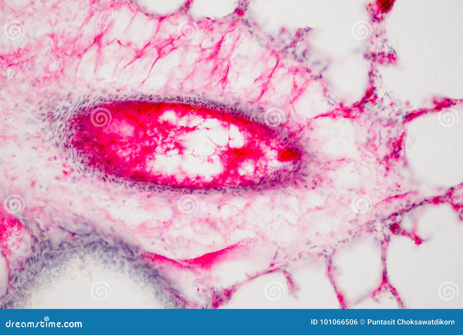 Menschliches Lungengewebe Unter Mikroskopansicht Stockfoto - Bild von ...