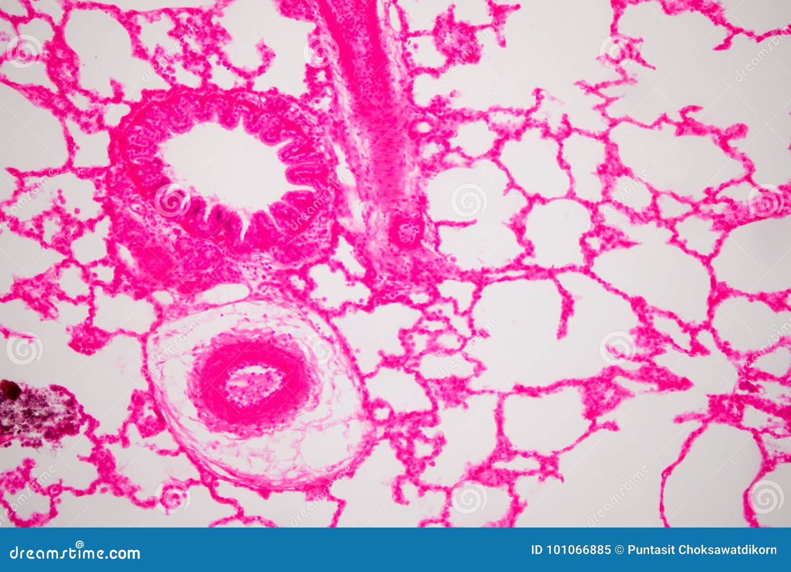 Menschliches Lungengewebe Unter Mikroskopansicht Stockbild - Bild von ...