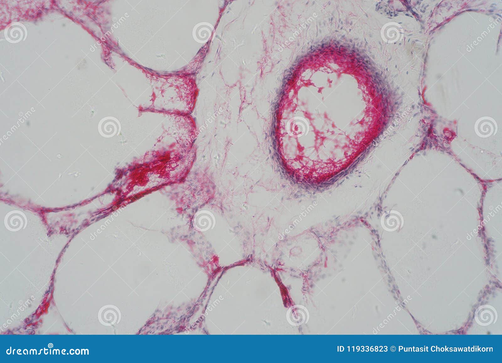 Menschliches Lungengewebe Unter Mikroskopansicht Stockbild - Bild von ...