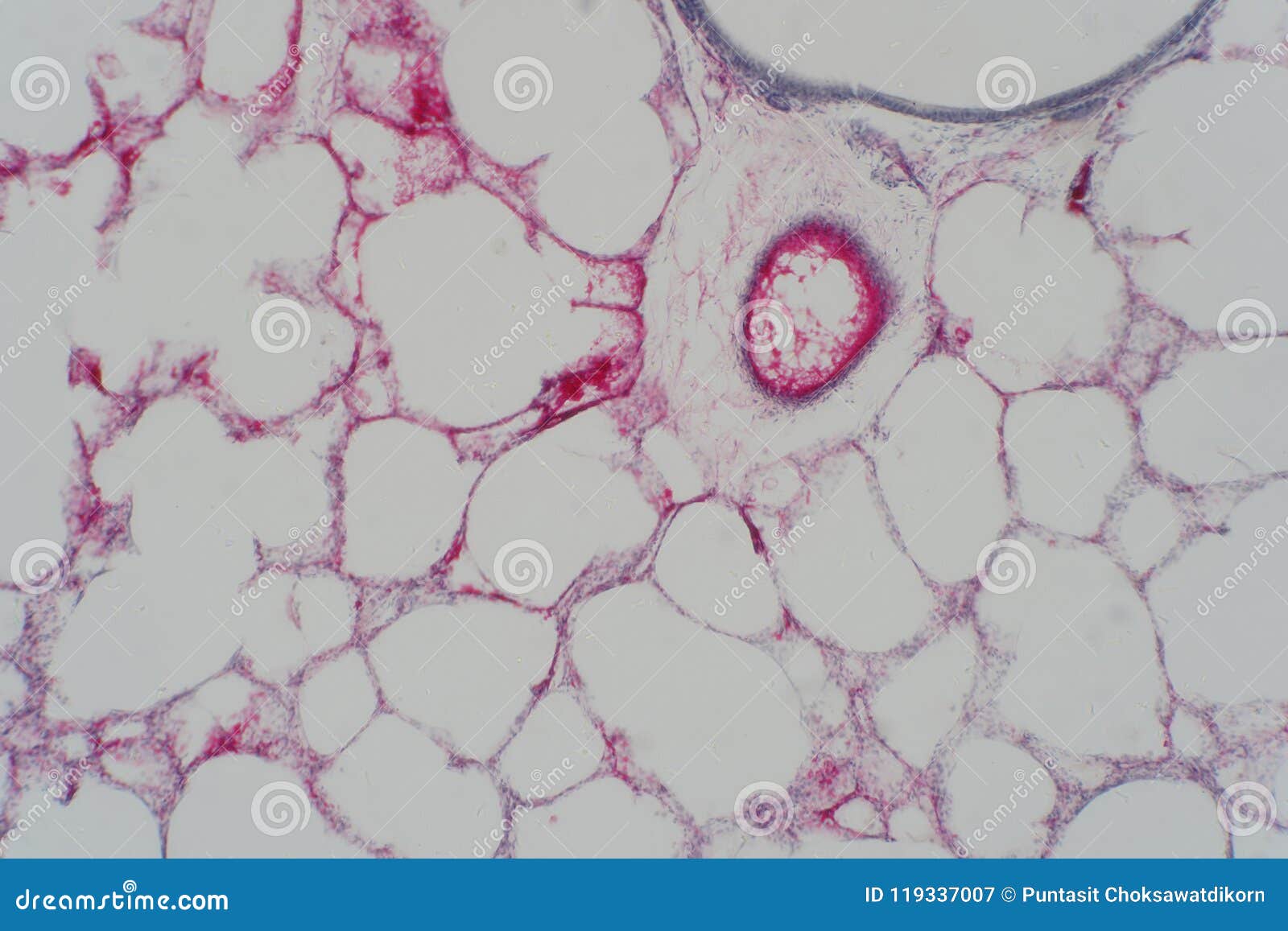 Menschliches Lungengewebe Unter Mikroskopansicht Stockbild - Bild von ...