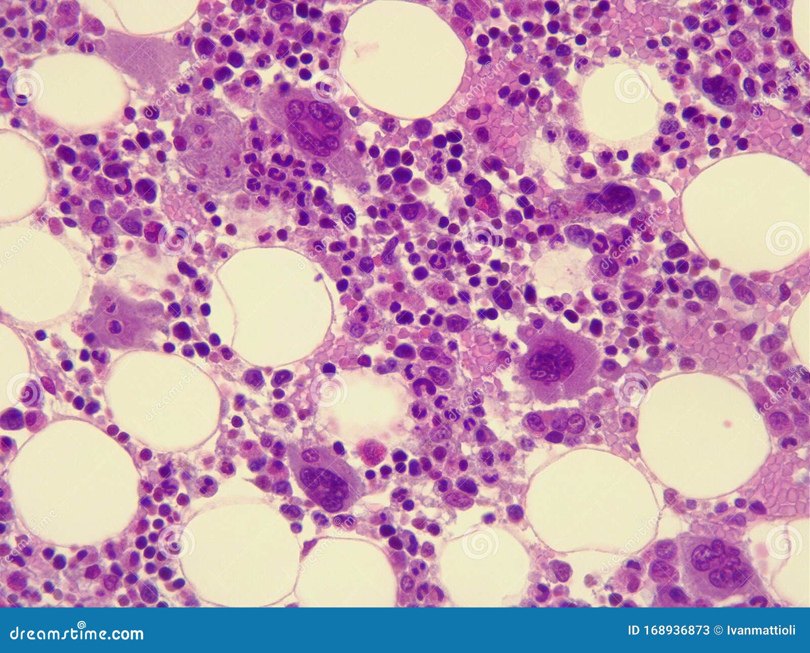 Menselijk Beenmerg Onder De Microscoop Stock Afbeelding - Image of ...