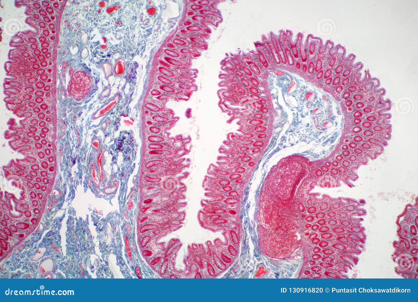 Menselijk Dikke Darmweefsel Onder Microscoopmening Stock Foto - Image ...