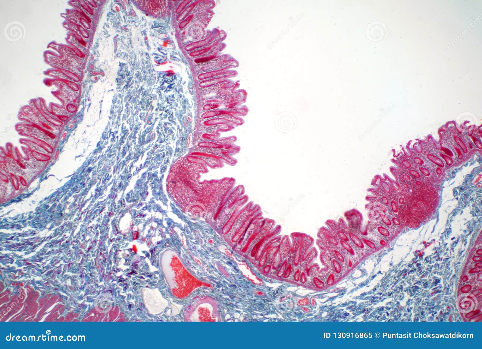 Menselijk Dikke Darmweefsel Onder Microscoopmening Stock Afbeelding ...