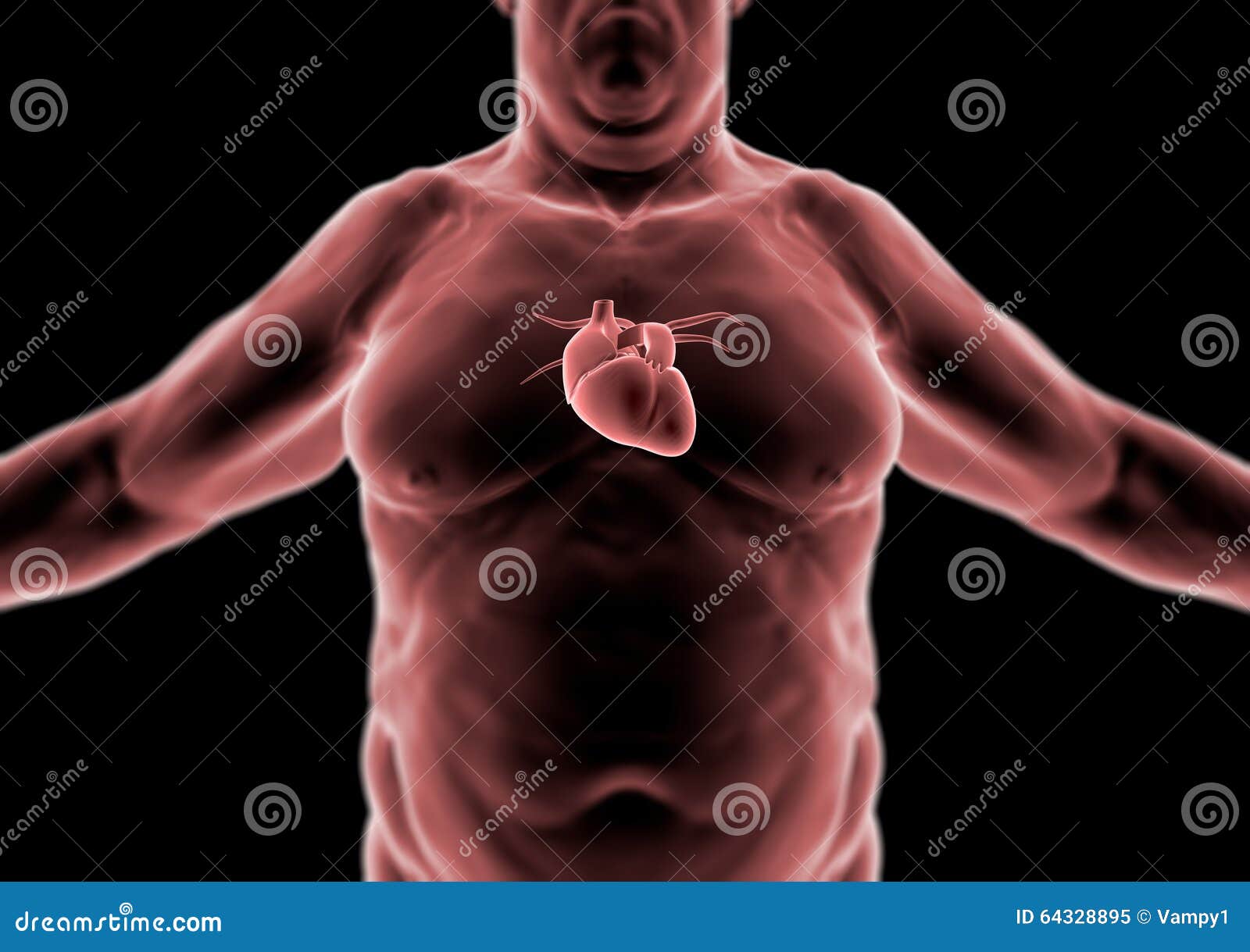 Menselijk Lichaam, Vette Persoon, Hart Stock Illustratie - Illustration ...