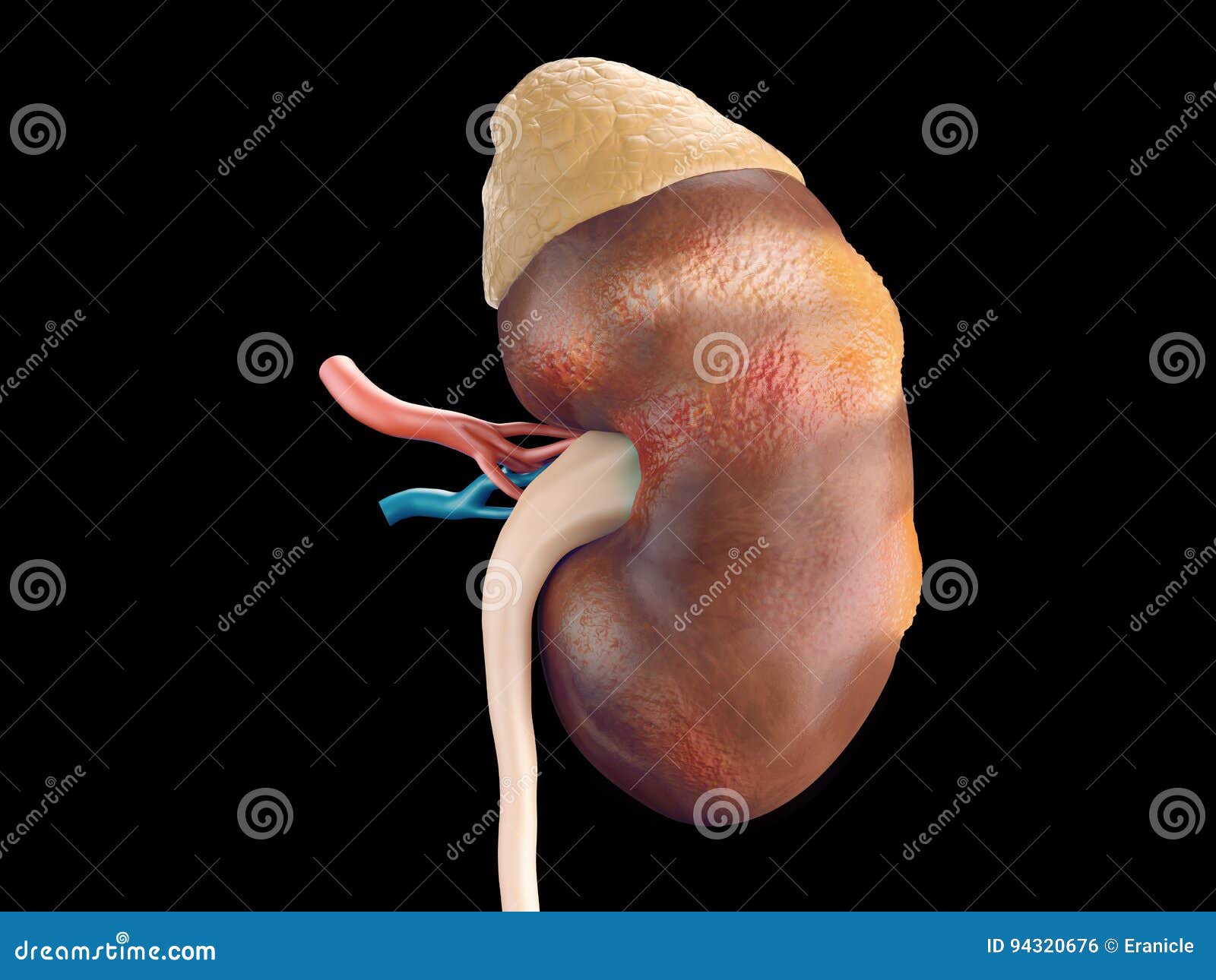 Menselijke nierkanker stock illustratie. Illustration of ontsteking ...
