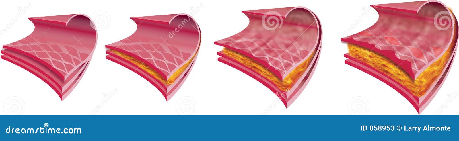 Menselijke Slagader 2 stock illustratie. Illustration of stadia - 858953