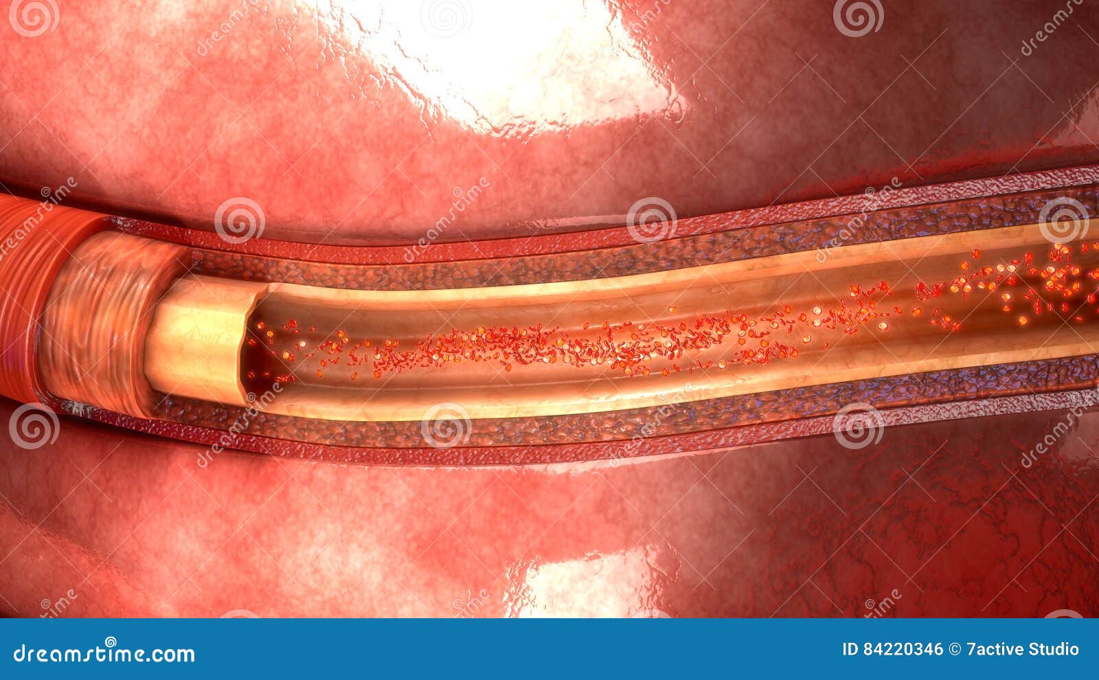 Menselijke Slagader stock foto. Image of hart, menselijk - 84220346