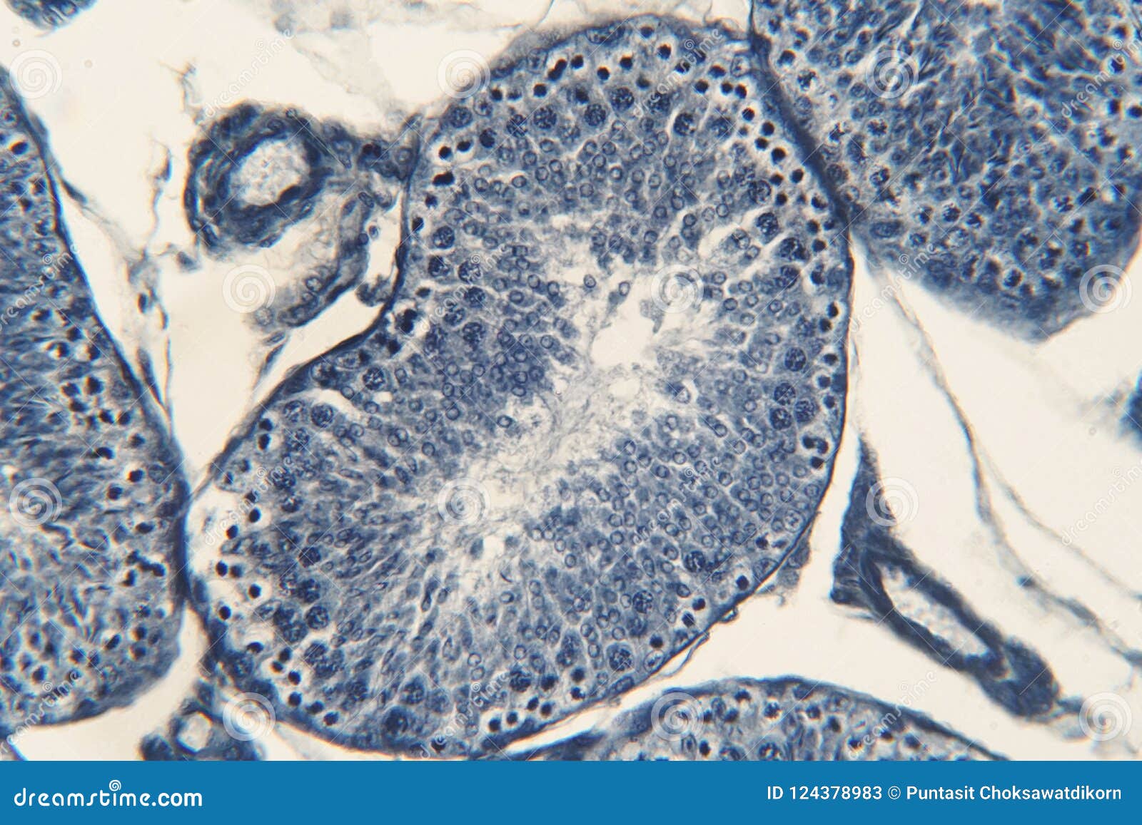 Menselijke Testikel Onder Microscoopmening Stock Afbeelding - Image of ...