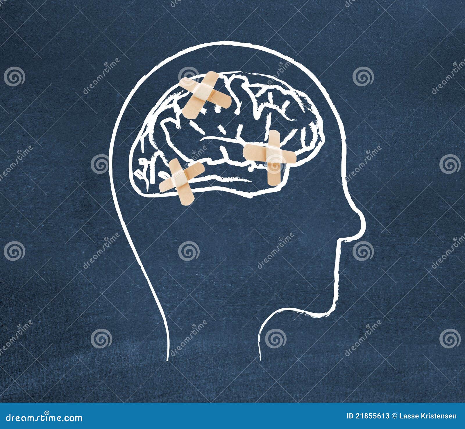 Mentally Challenged Brain