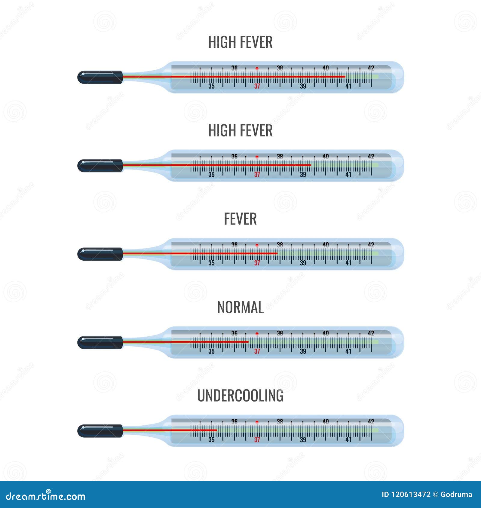 Mercury Thermometers Showing High Fever And Normal Temperature Stock