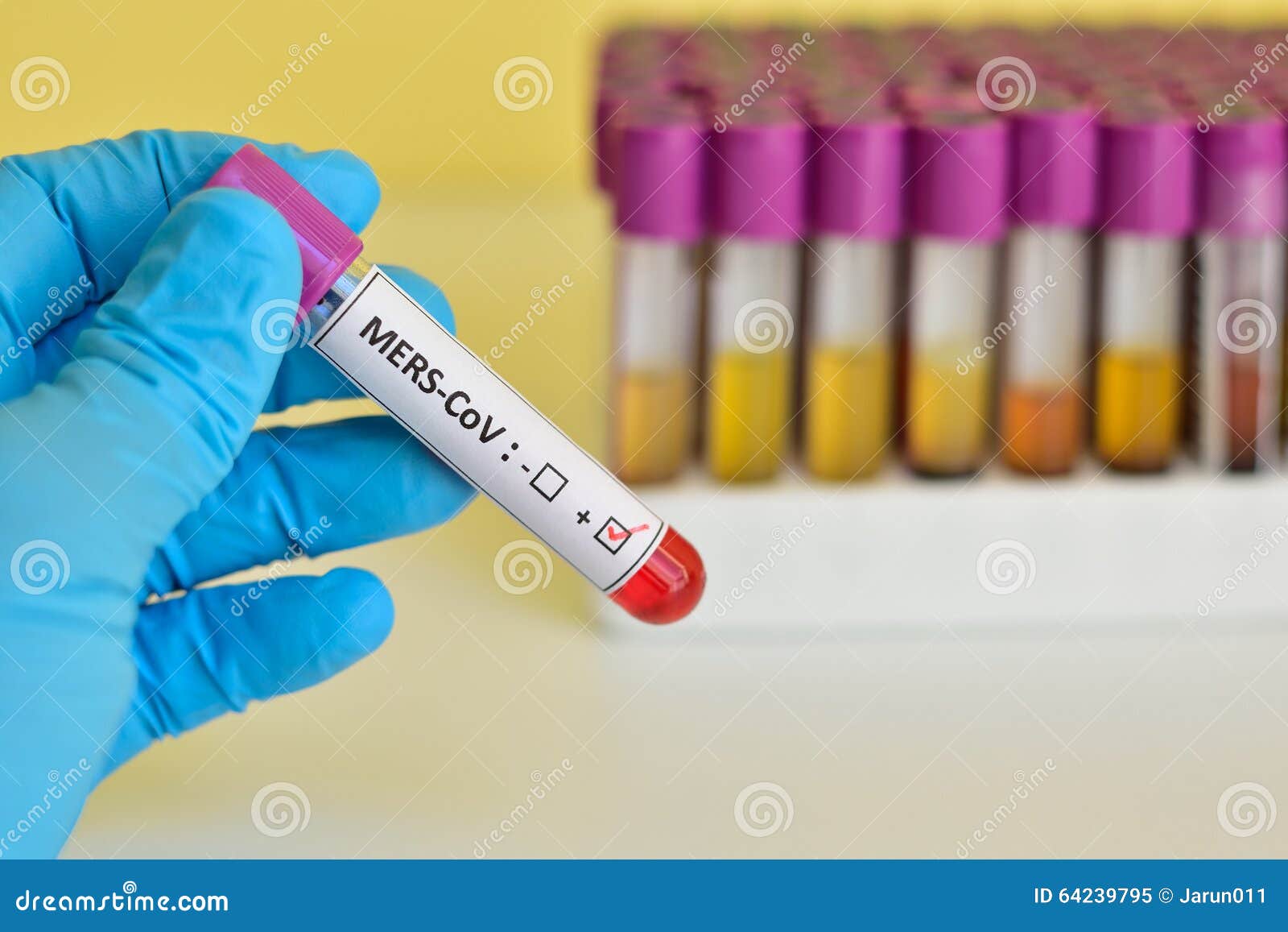MERS virus blood sample stock image. Image of laboratory - 64239795