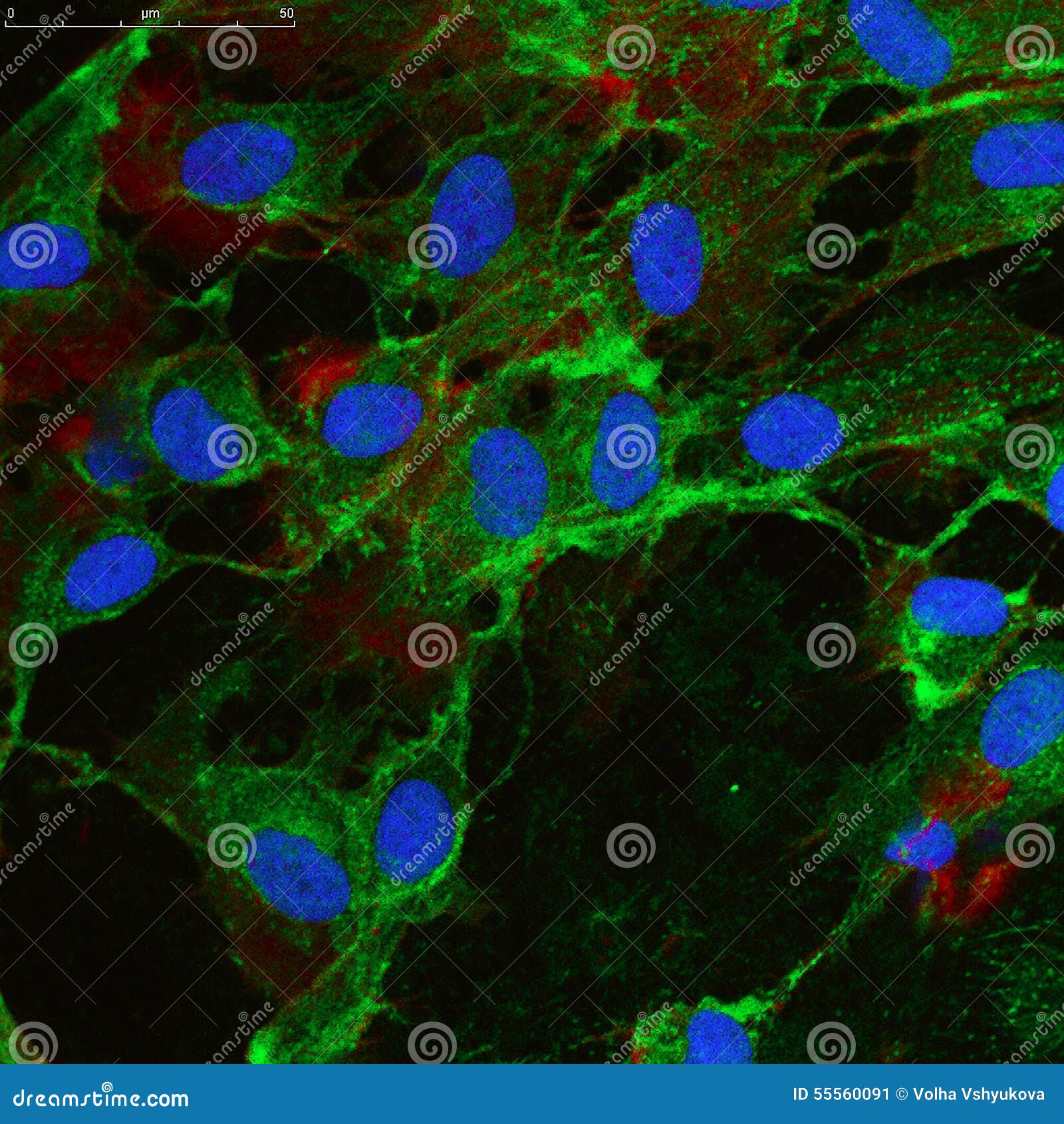 Cells Labeled With Fluorescent Molecules Royalty-Free Stock Photo ...