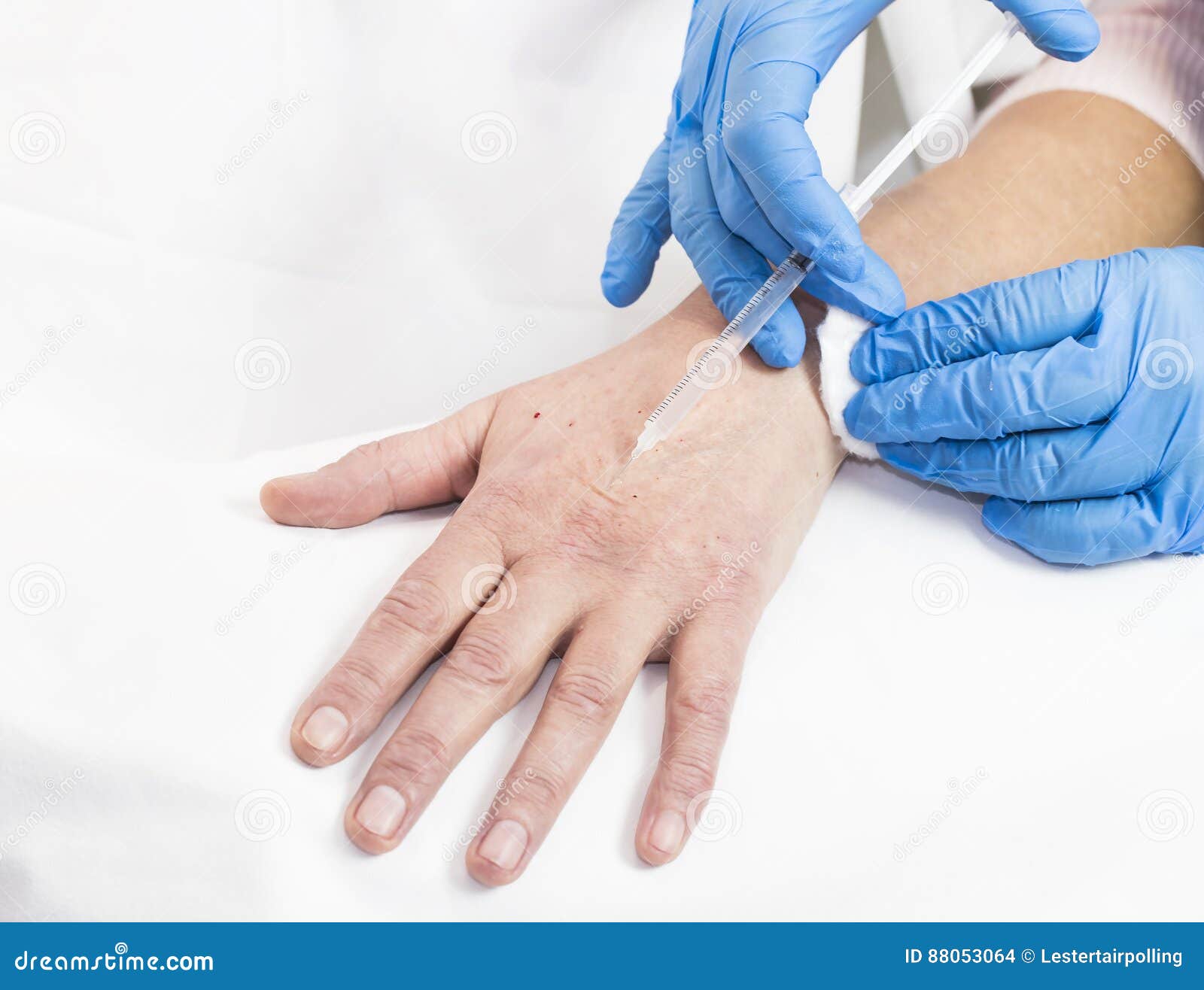 Mesotherapy Process on a Female Hand Stock Photo - Image of girl, latex ...