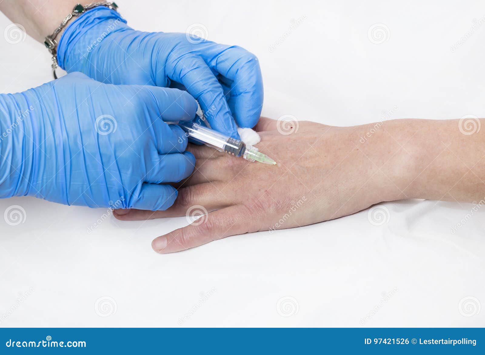 Mesotherapy Process on a Female Hand Stock Photo - Image of hand ...