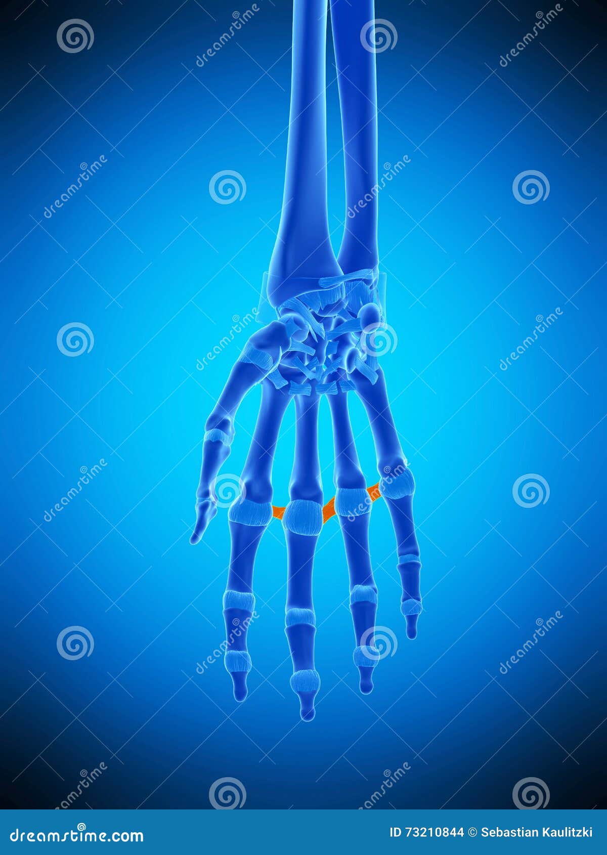3D Illustration Of Of Metacarpal X-ray | CartoonDealer.com #145221817