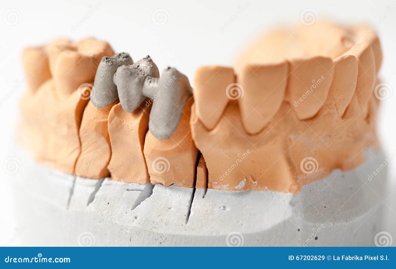 Metal Ceramic Bridge Structure Stock Image - Image of equipment ...