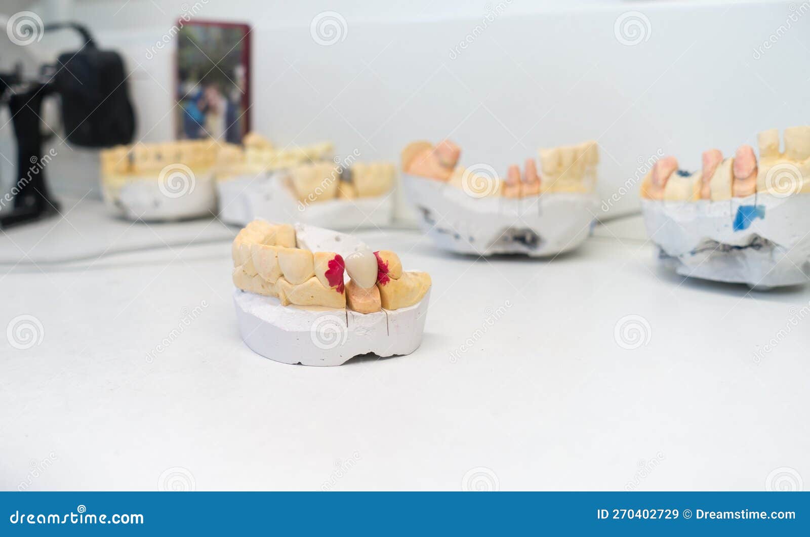 Metal-ceramic Dental Crowns And Bridges. Dental Prosthetics. Artificial ...