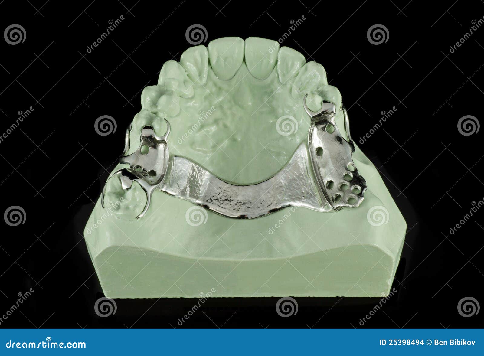 Metal Framework stock photo. Image of health, shiny, dentistry - 25398494