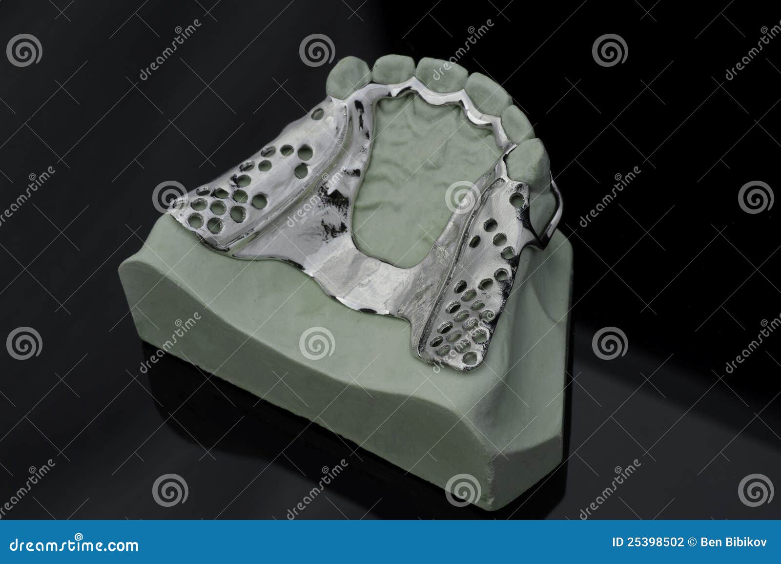 Metal Framework stock photo. Image of mouth, teeth, cast - 25398502