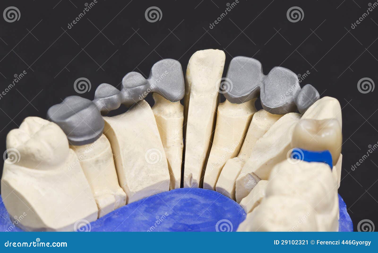 Metal Framework For A Dental Bridge Stock Image - Image: 29102321