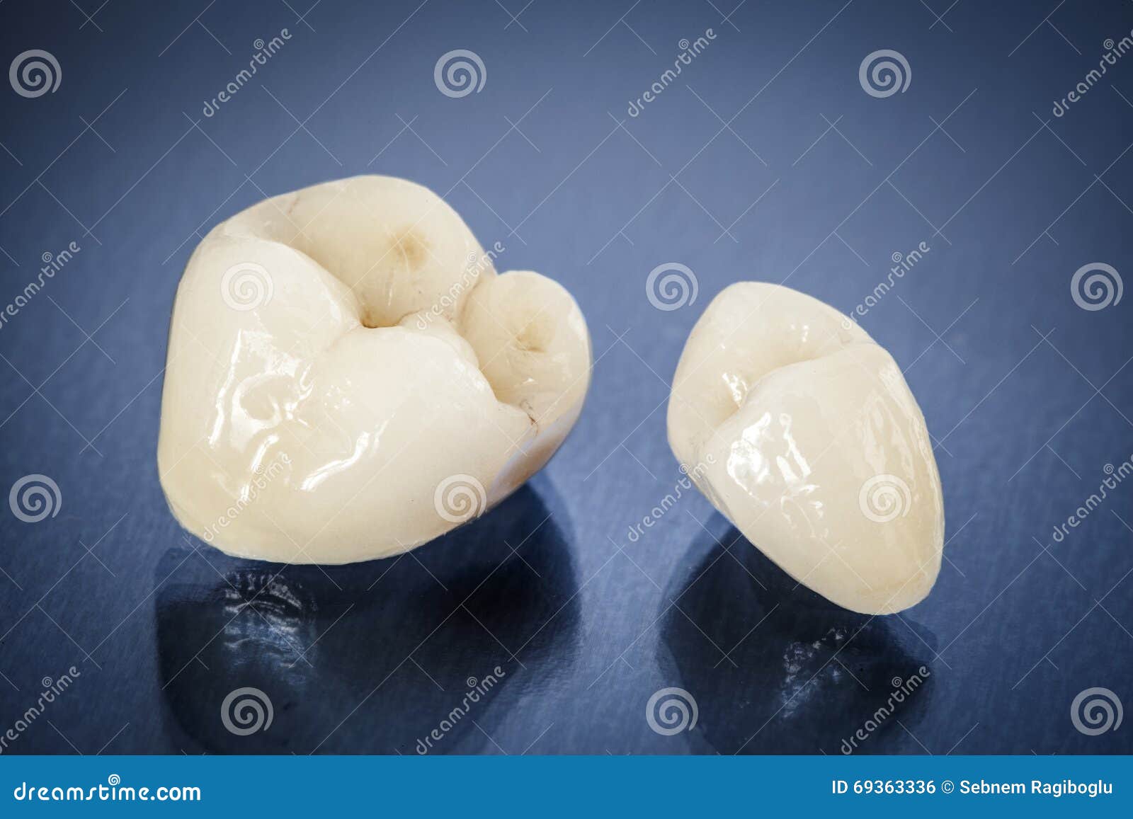 Set Of Dental Crowns Model Made Of Ceramic For Studying Morphology And ...