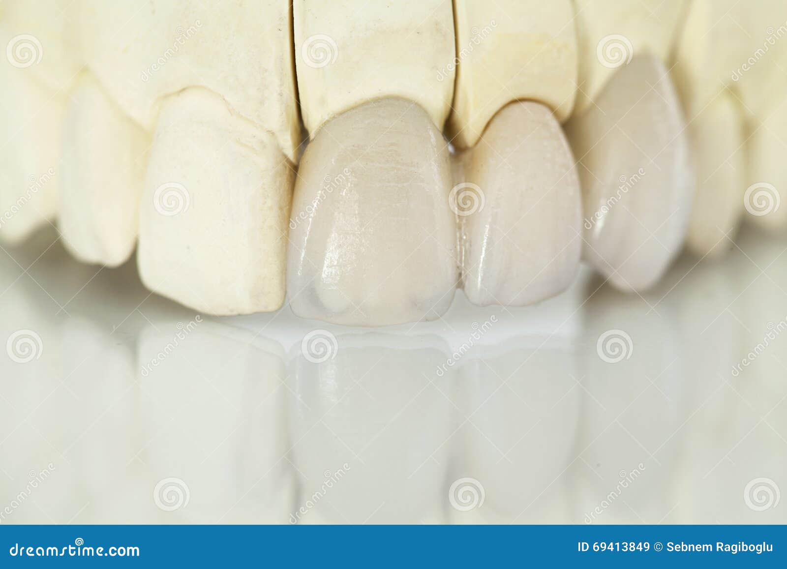 Metal Free Ceramic Dental Crowns Stock Photography | CartoonDealer.com ...
